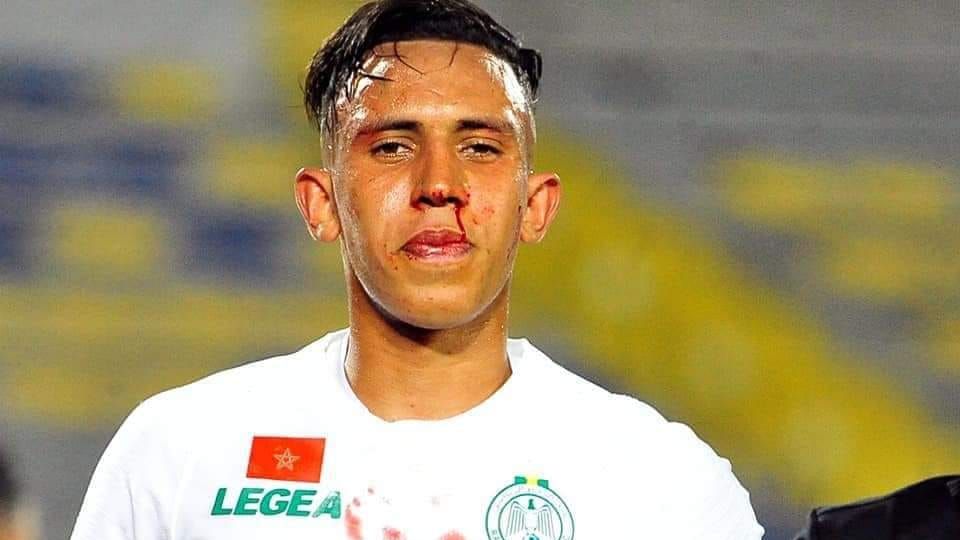 Soufiane Rahimi opéré d'une double fracture du nez